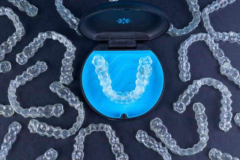 What Are the Different Packages of Invisalign Available?